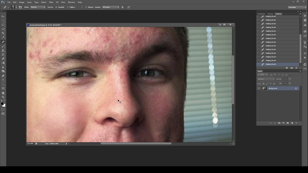 Retouch heavy acne face - YouTube