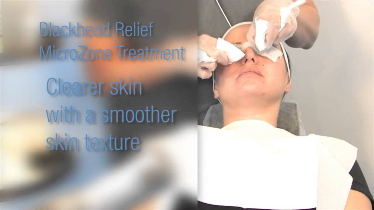 Blackhead Relief MicroZone® | Dermalogica - YouTube