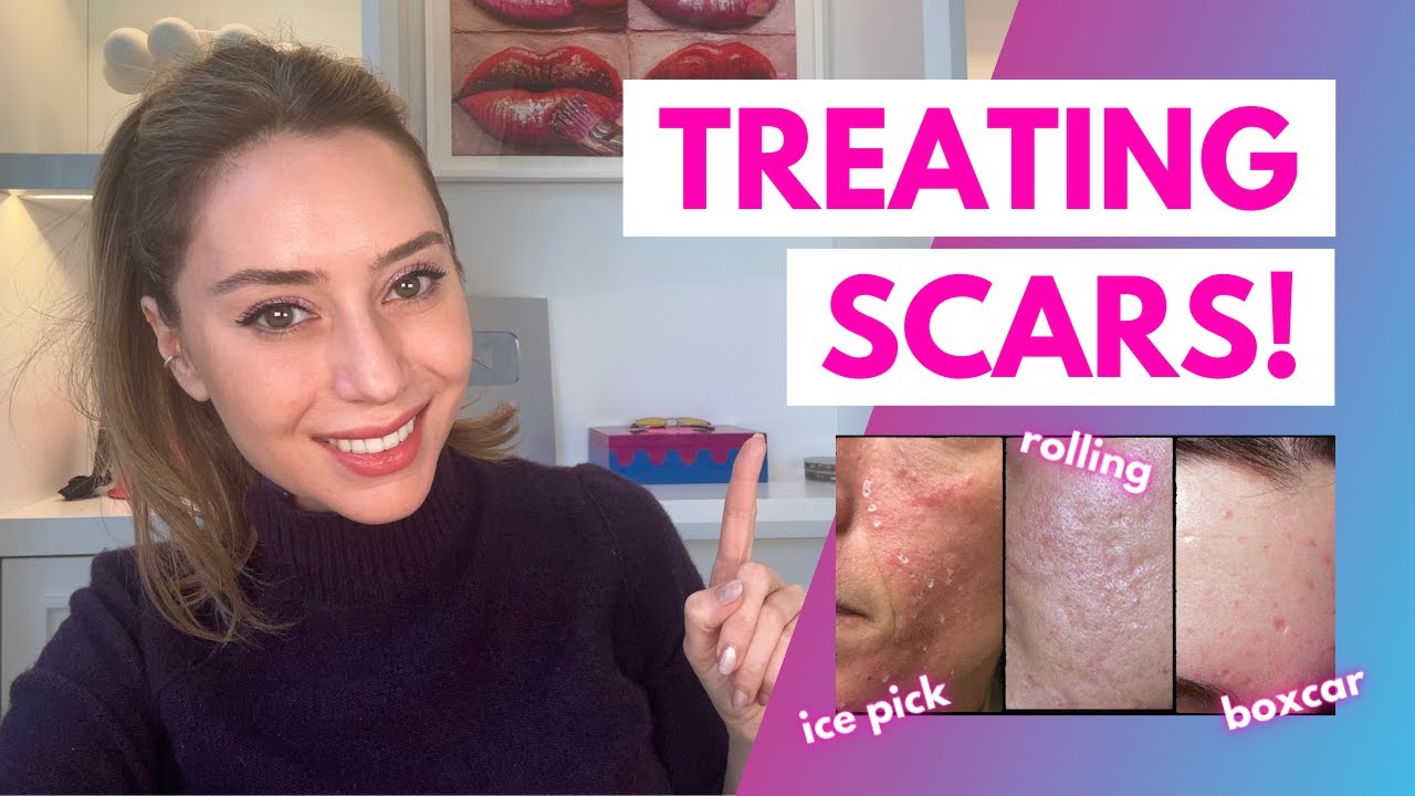 How To Treat Scars: Flat, Depressed, Raised, and Keloids | Dr. Shereene ...