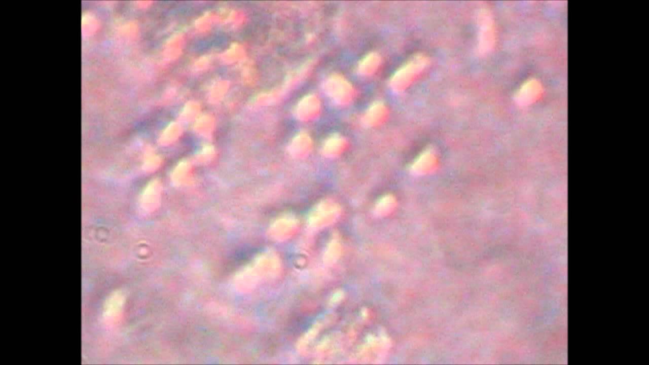 beating heart cells.wmv - YouTube