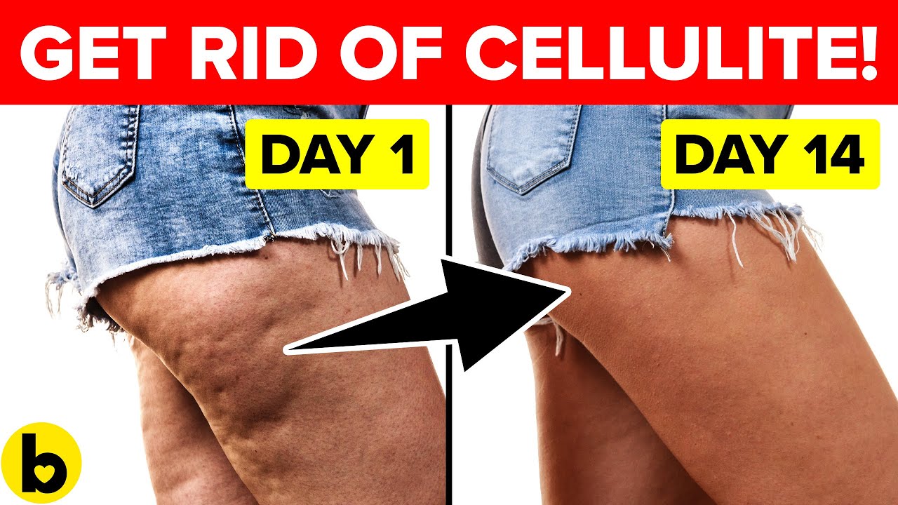 10 Exercises That Will Blast Away Body Cellulite In Just 2 Weeks - YouTube
