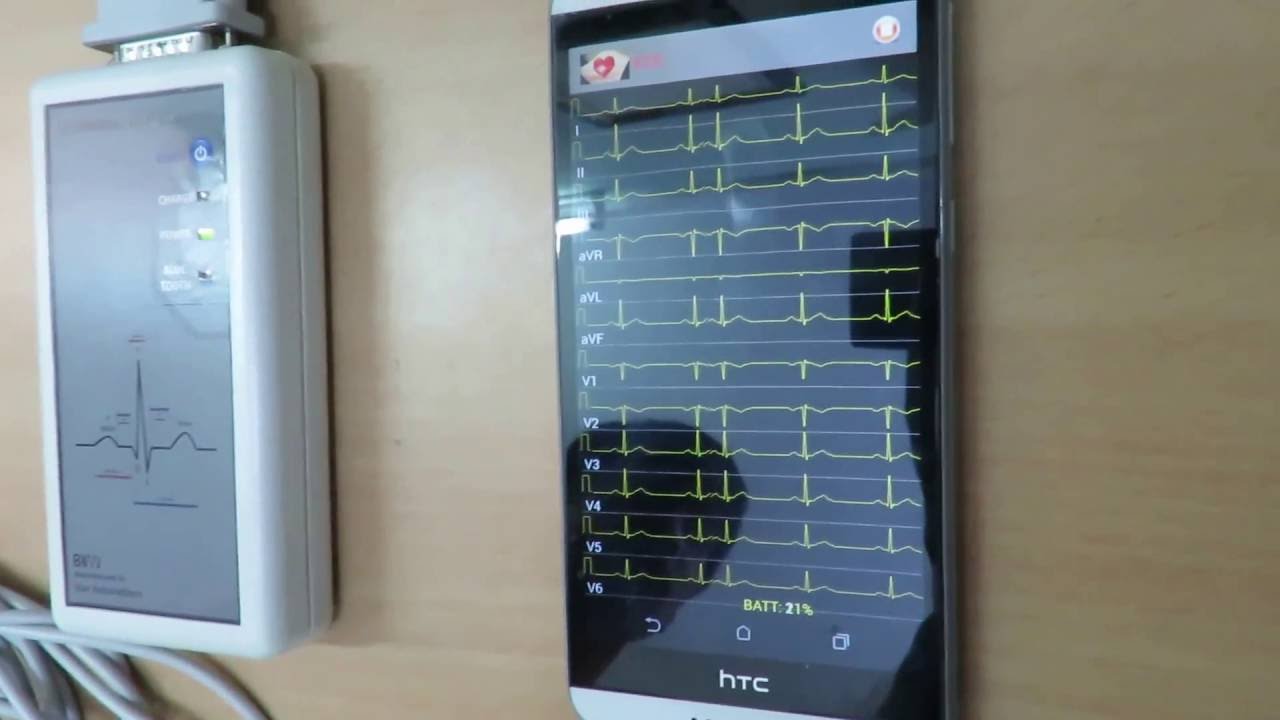 Handheld 12-Channel Tele-ECG Instrument - YouTube