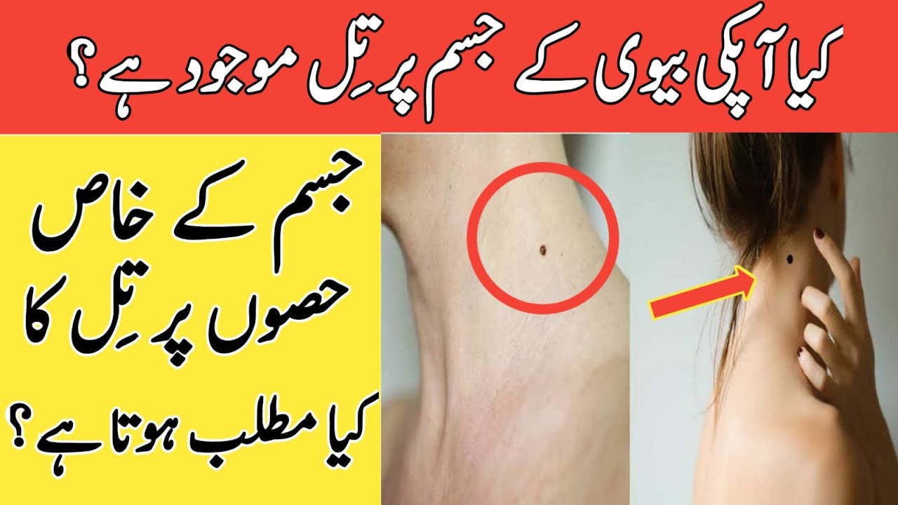 Facts About Mole on Body || Facts About Human Body || Informative Video ...