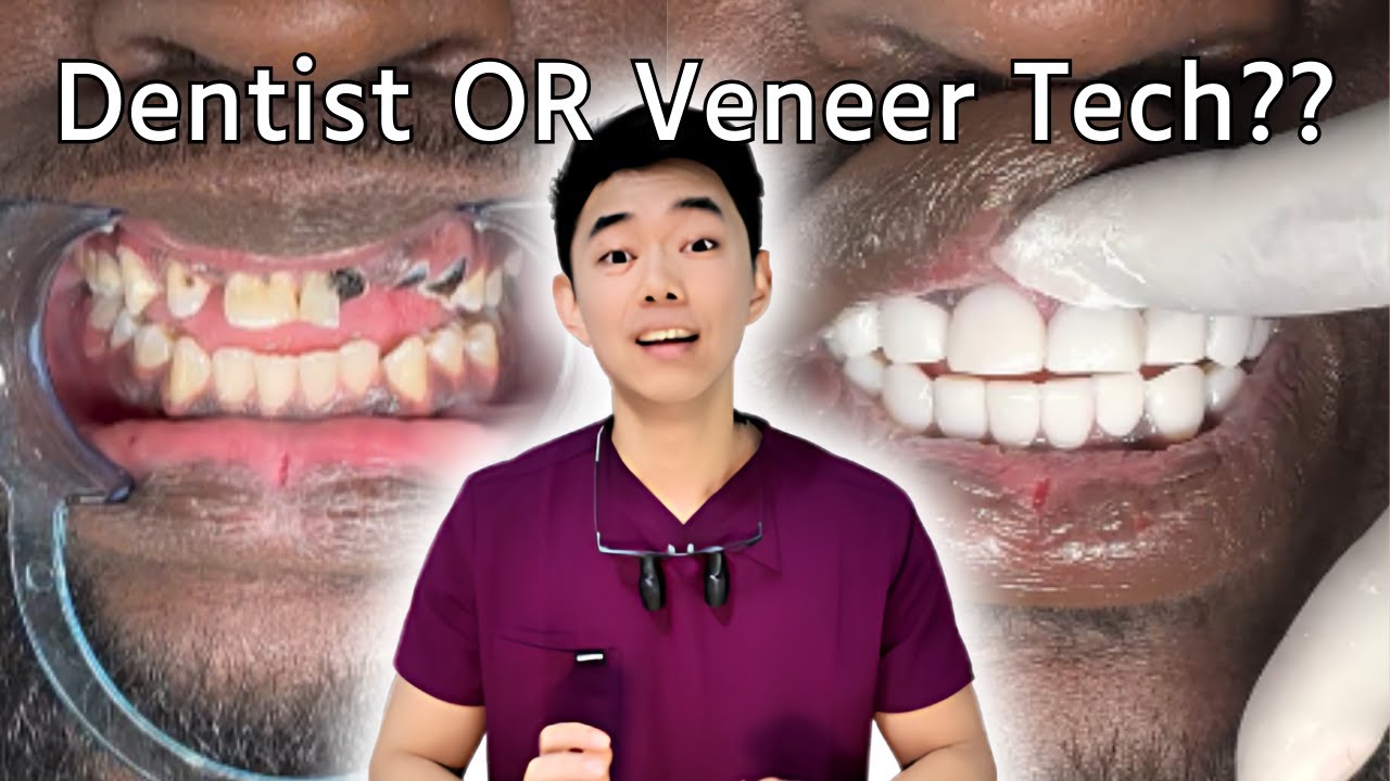 Veneer Tech Composite Veneers - Risks and Benefits (Dentist REACTS ...