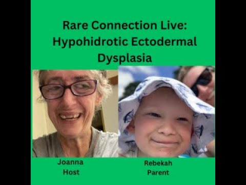 Hypohydrotic Ectodermal Dysplasia With Rebecca From Oregon - YouTube