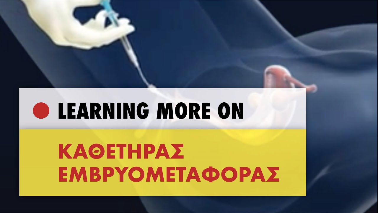 Καθετήρας Εμβρυομεταφοράς - YouTube