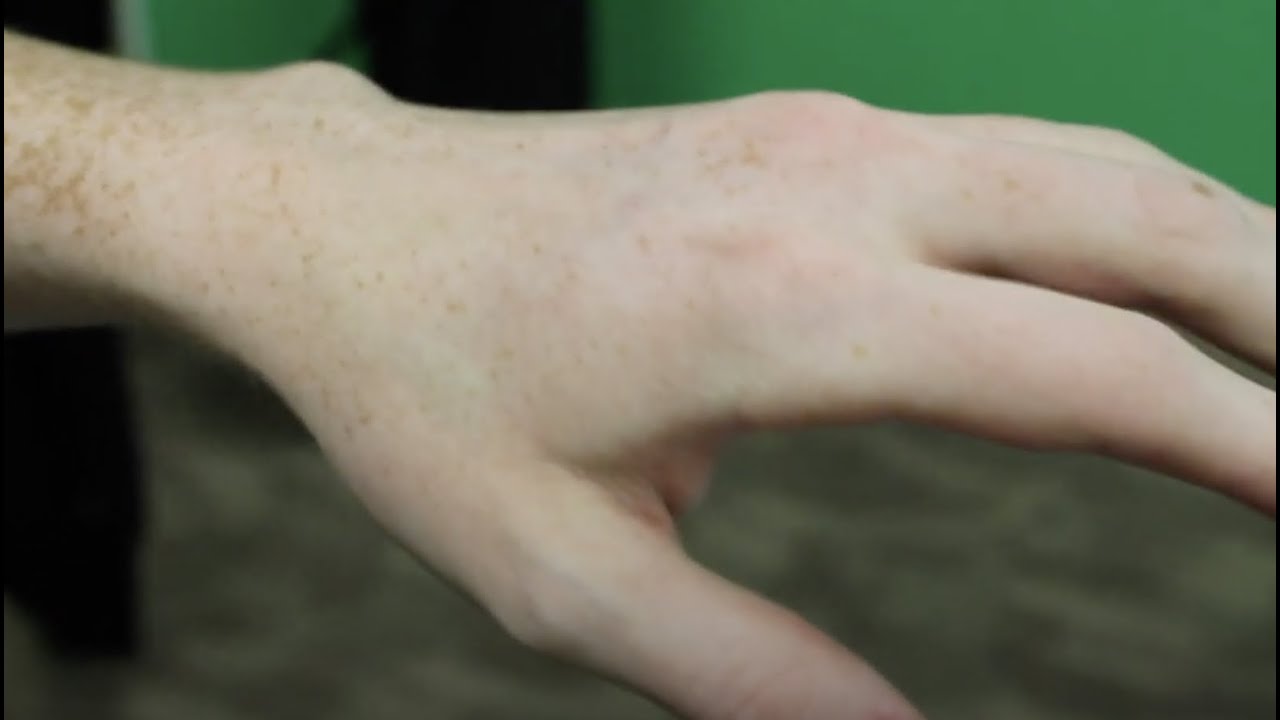 Gretna Stories: Jack Pederson and His Microchip - YouTube