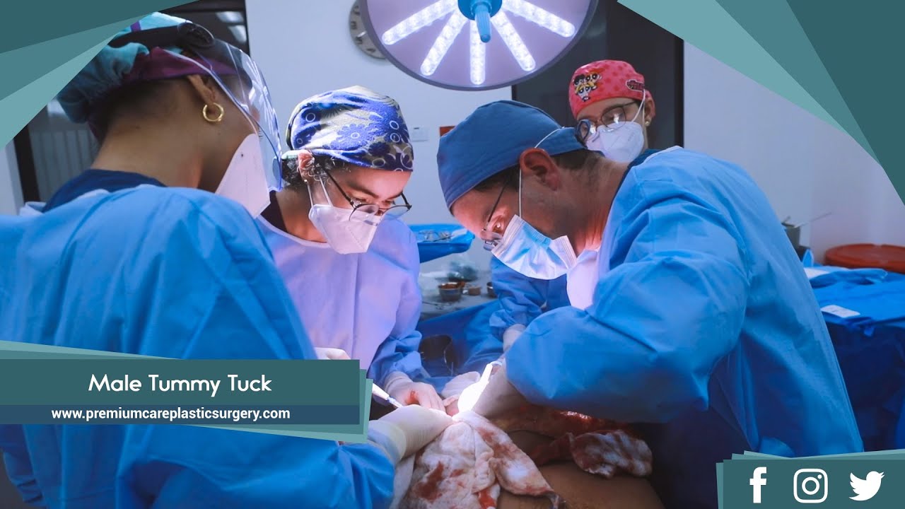Extended Tummy Tuck Revision in Male Patient - YouTube