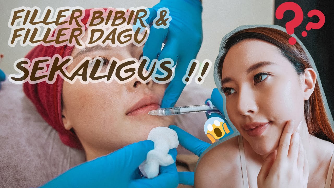 Filler Bibir & Filler Dagu Tanpa Sensor Total 11 Jutaan!!! | ft. The ...