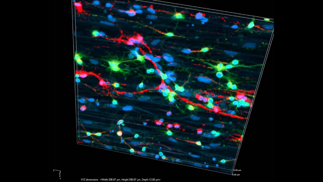 Differentiation of neural stem cells on a micro patterned surface - YouTube