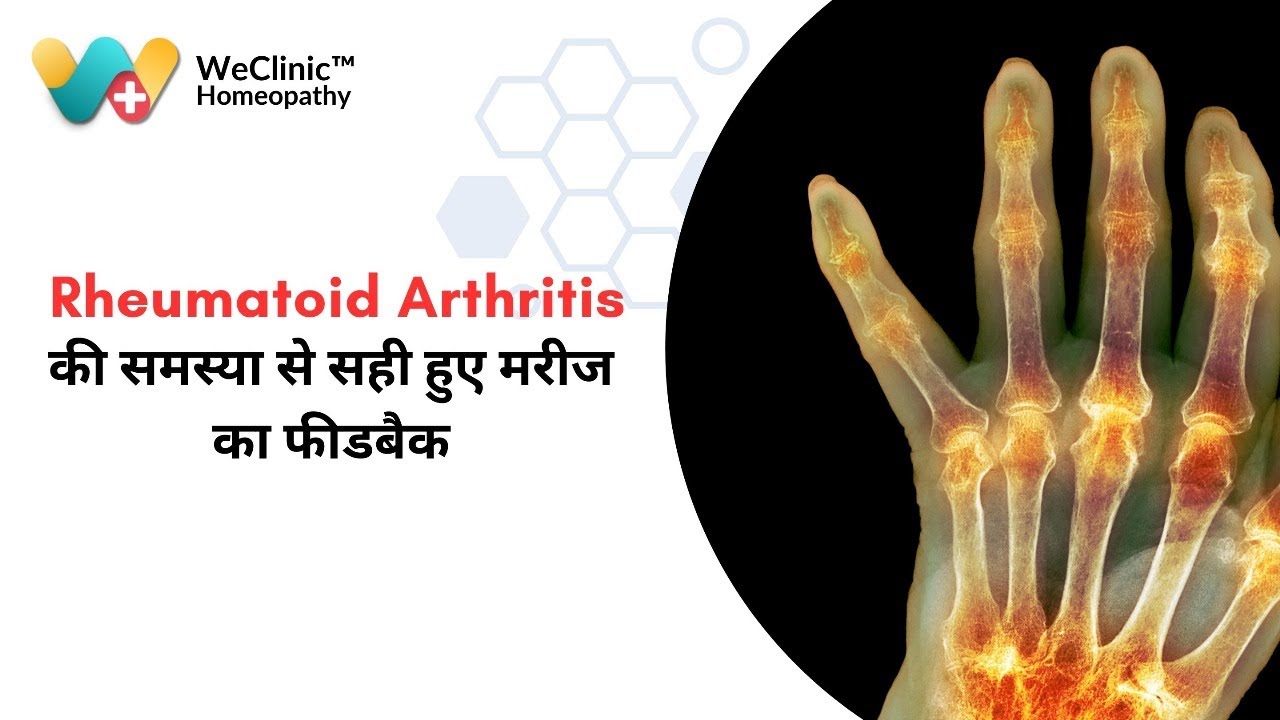 rheumatoid arthritis (RA) Recovery Success Story Of Arvind Ji | - YouTube