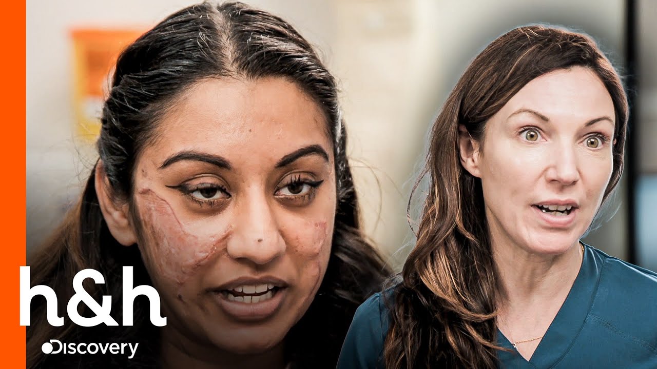 Tratamento para o caso grave de "pioderma gangrenoso" | Dra. Emma: Uma ...