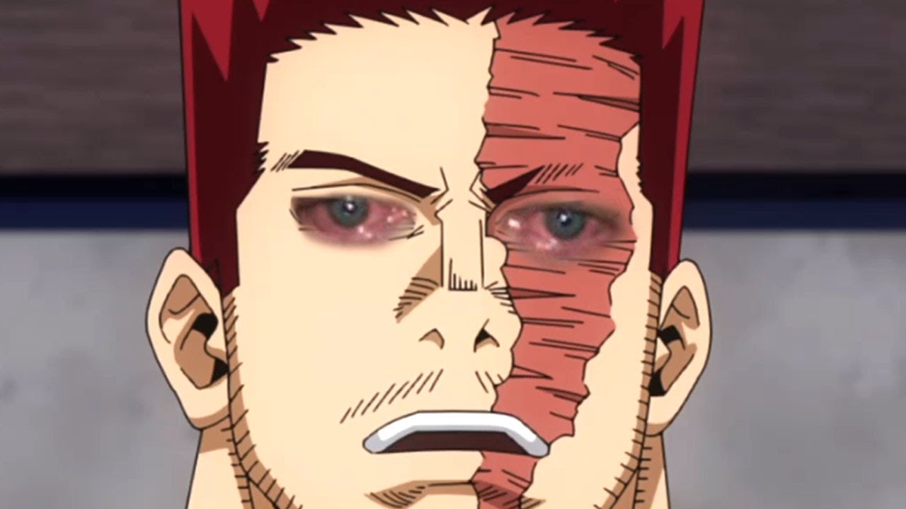 Endeavor Has A Bad Scar... - YouTube