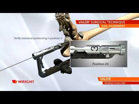 VALOR NAIL - YouTube