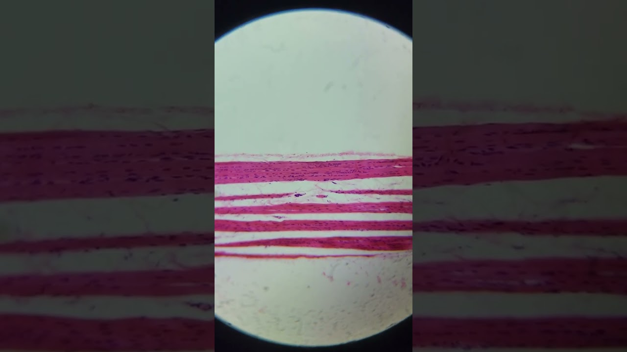 Skeletal Muscle 400x Magnification