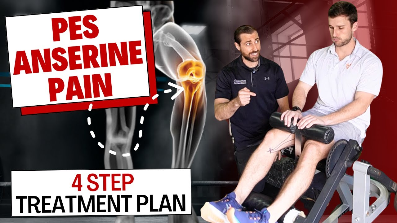 4 Steps to TREAT PES ANSERINE Pain FAST - YouTube