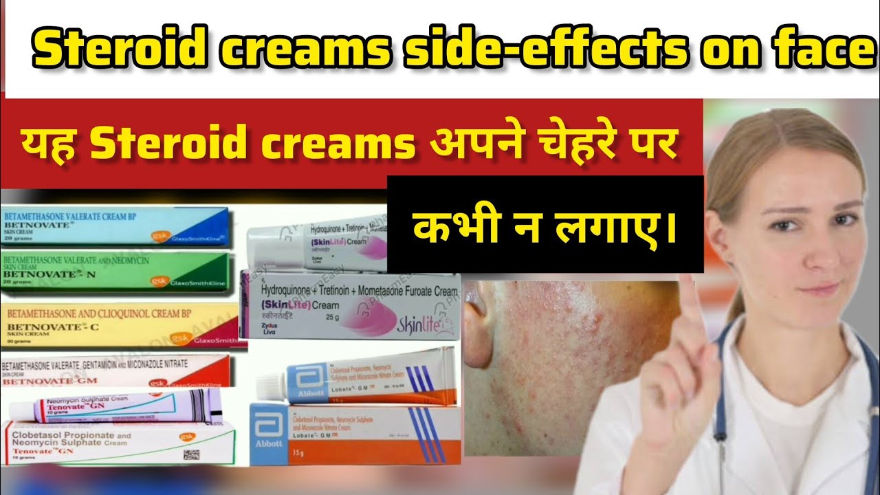 steroid creams side effects on face #steroids #incrediblehealthhindi ...
