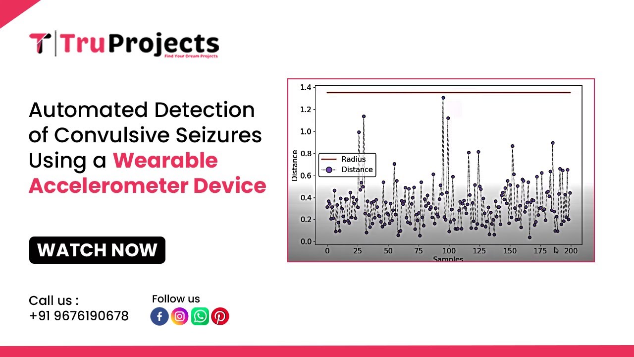 Automated Detection of Convulsive Seizures Using a Wearable ...