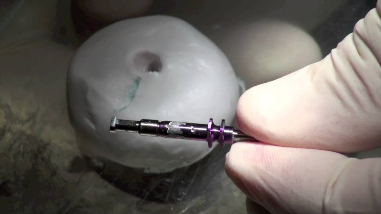 Custom Impression Copings - NobelActive Dental Implant - YouTube