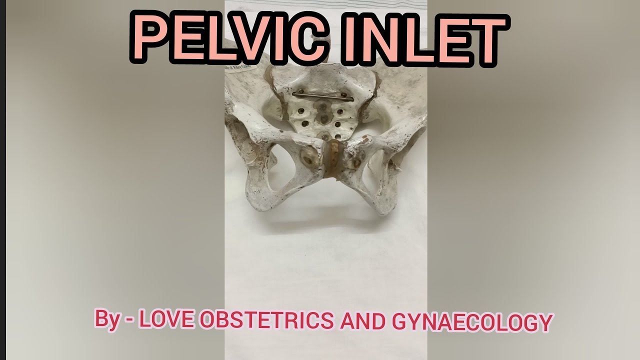 Pelvic Inlet and Pelvic Brim Boundaries & Diameters - By Love ...