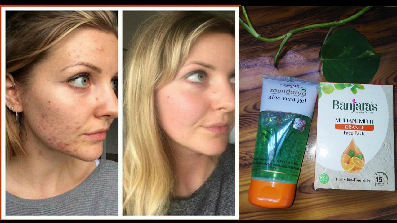 ORANGE PEEL FACE PACK/BRIGHT SKIN/OIL FREE LOOK/ACNE FREE SKIN - YouTube
