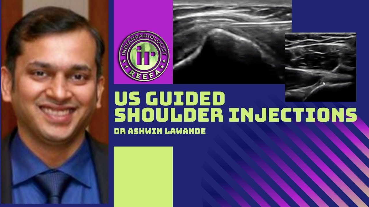 USG Guided Shoulder Injections by Dr Ashwin Lawande - YouTube