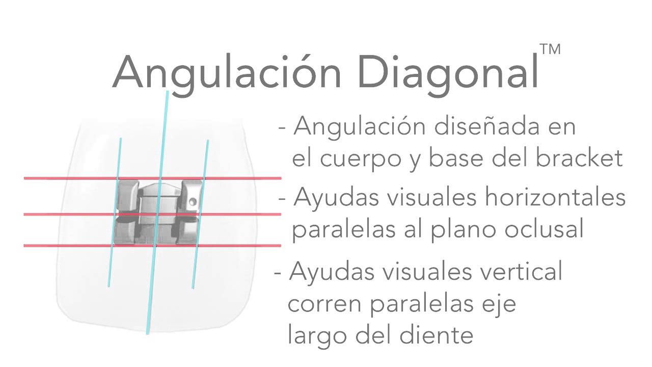 Brackets Serie Master American Orthodontics - YouTube