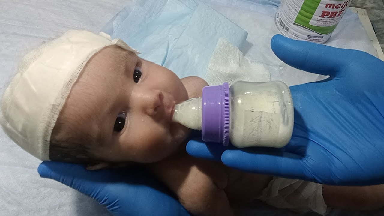 👶 Newborn Baby Diagnosis Meningitis | Feeding Tube Procedure | NICU ...