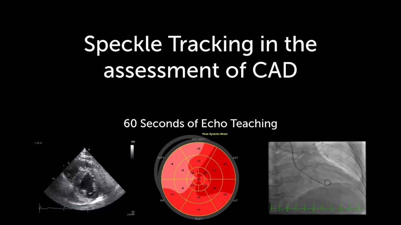 Automated Functioning Imaging (AFI) explained! - YouTube