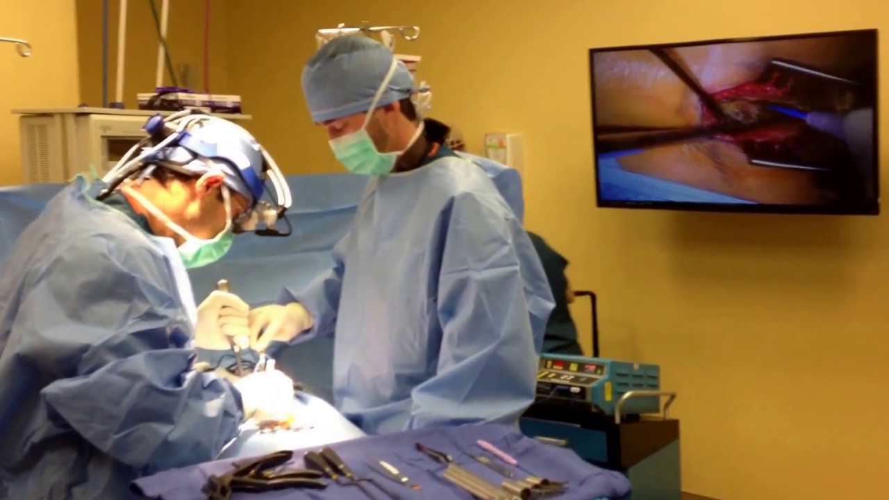 Microdisectomy / Microdecompression by Arash Yaghoobian MD - YouTube