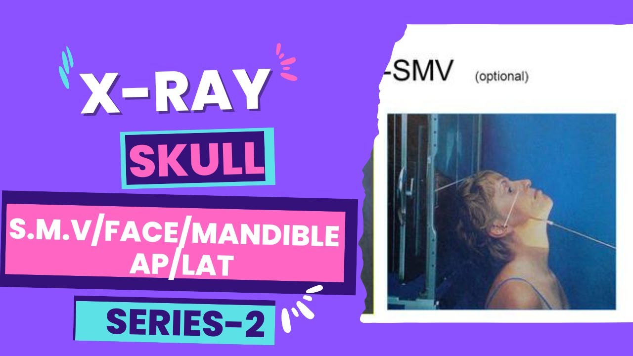 X-Ray Skull Series-2 |SMV|Face|mandible|AP#PA|Oblique|#Lat View |IN ...