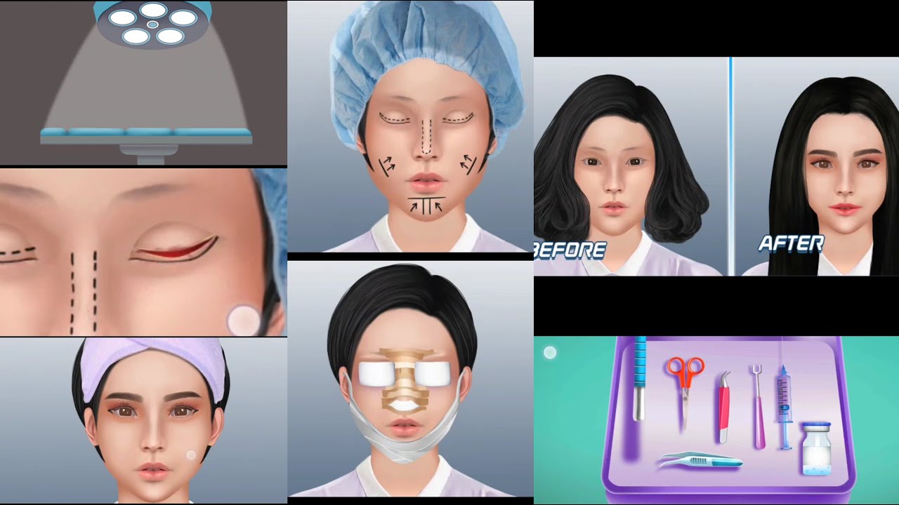 ASMR | Complete process of plastic surgery | Animation - YouTube