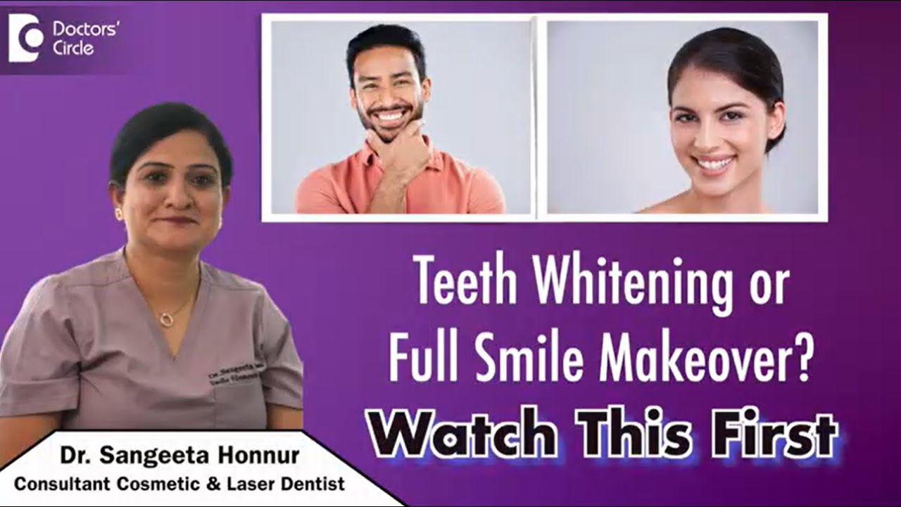 Smile Makeover vs Whitening | Watch This Before You Decide - Dr ...