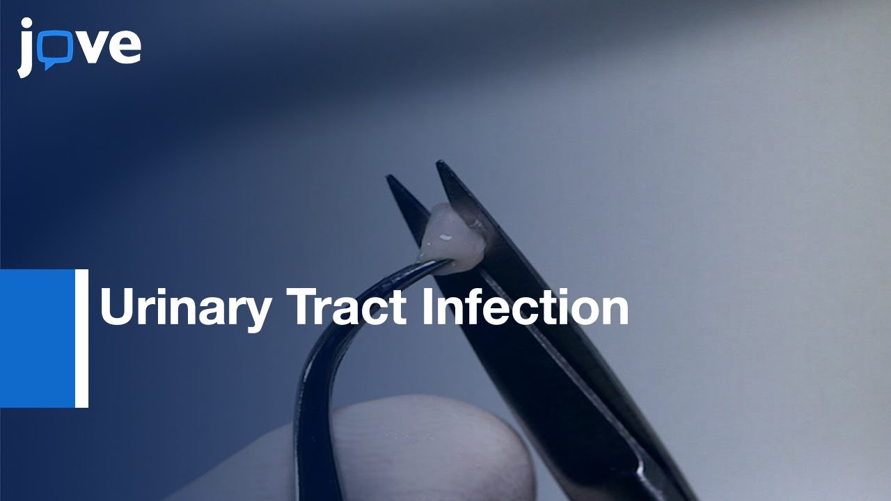Urinary Tract Infection Assessment by Transurethral Catheterization ...