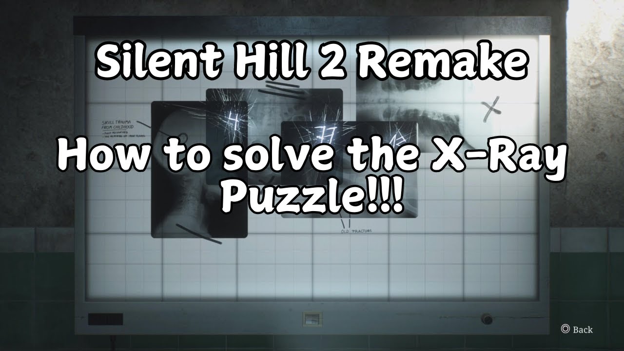 Silent Hill 2 Remake X-Ray Puzzle Solution - YouTube