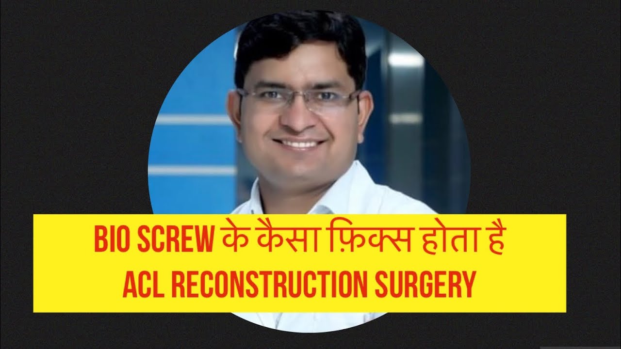 ACL reconstruction screw Surgery: BIO screw provides strong fixation ...