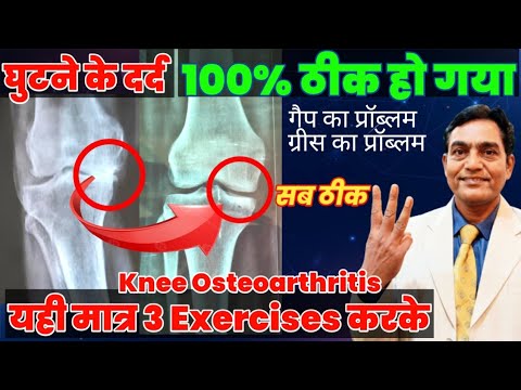 सिर्फ 3 Exercises कर के घुटने का दर्द 100 % ठीक हुआ | knee pain ...
