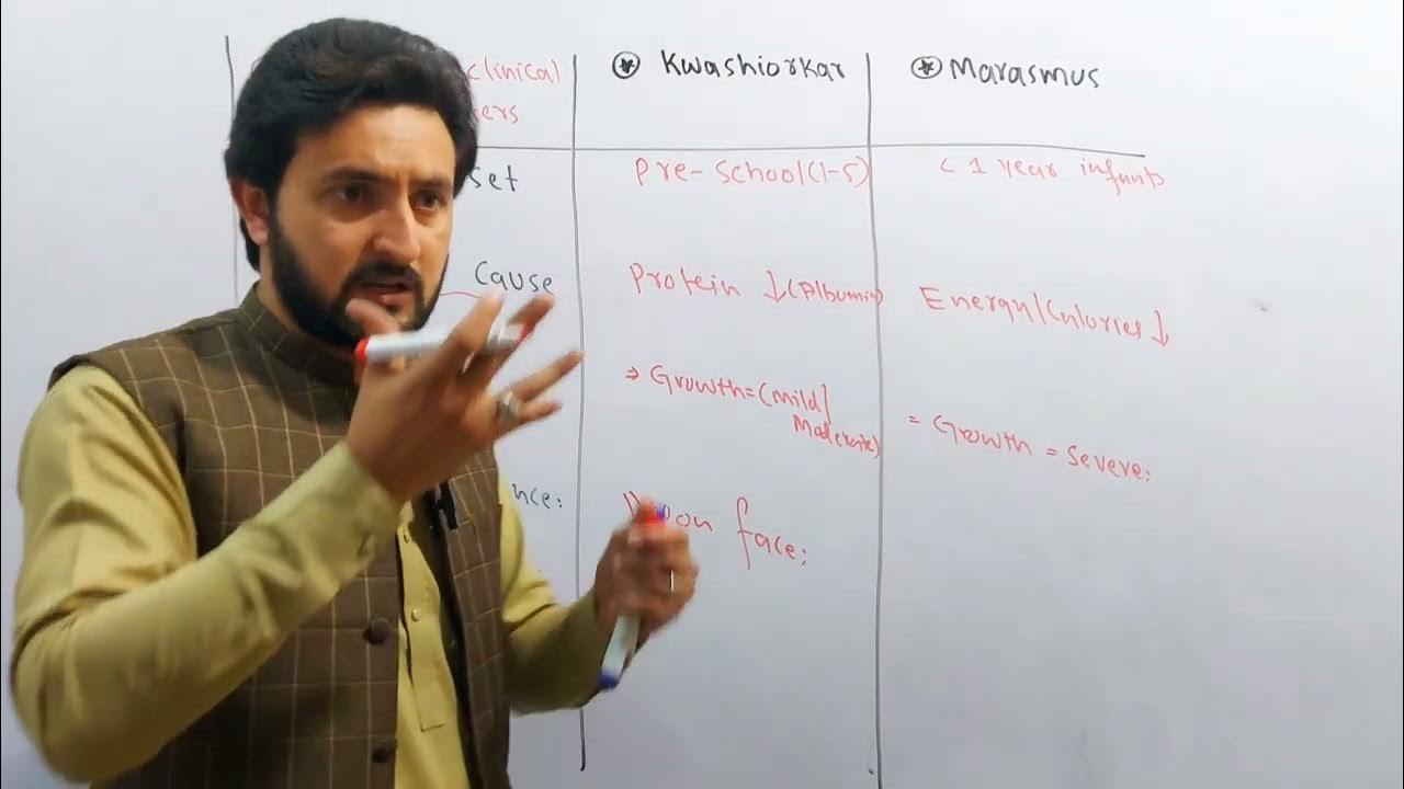 Difference between Kwashiorkor and Marasmus| Urdu Hindi Lecture by ...