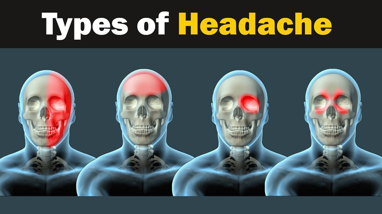 Headache - Types and causes | 3d Animation