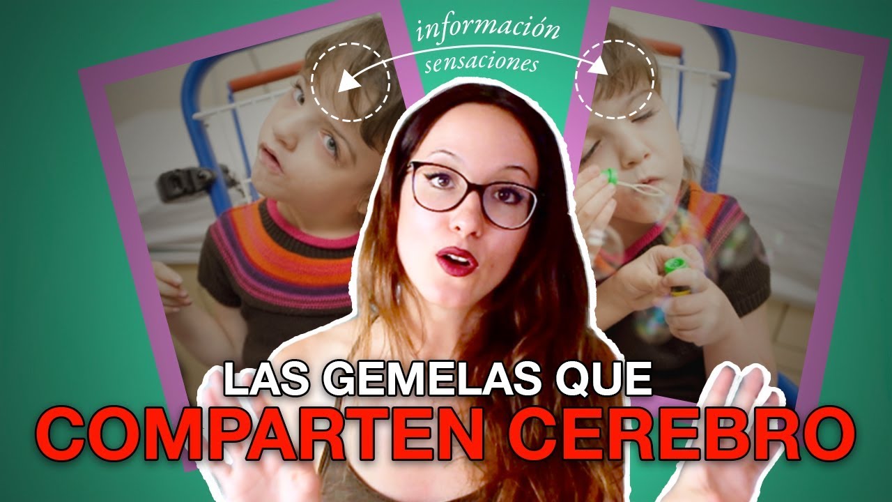 LAS GEMELAS QUE COMPARTEN CEREBRO | Tatiana y Krista Hogan - YouTube