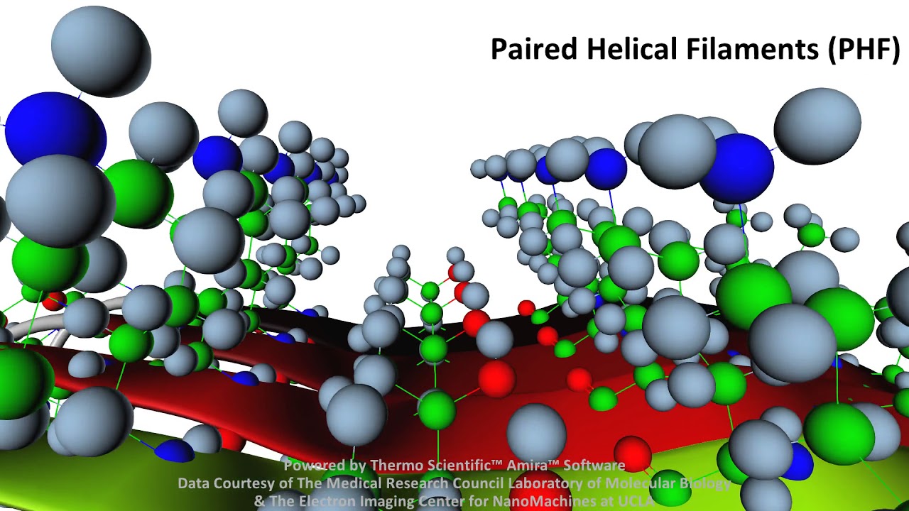 Cryo-EM structure of tau filaments from Alzheimer’s disease brain - YouTube