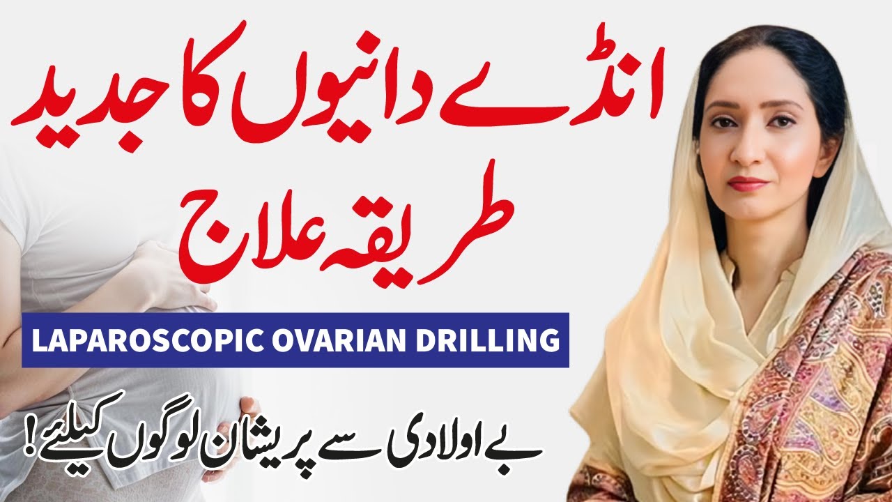 Ovarian Drilling for PCOS: Benefits, Purpose & Fertility Outcome ...