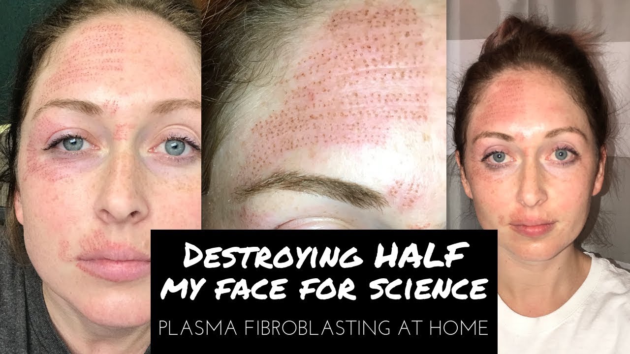 I DESTROYED HALF MY FACE FOR SCIENCE | DON’T TRY THIS AT HOME - YouTube