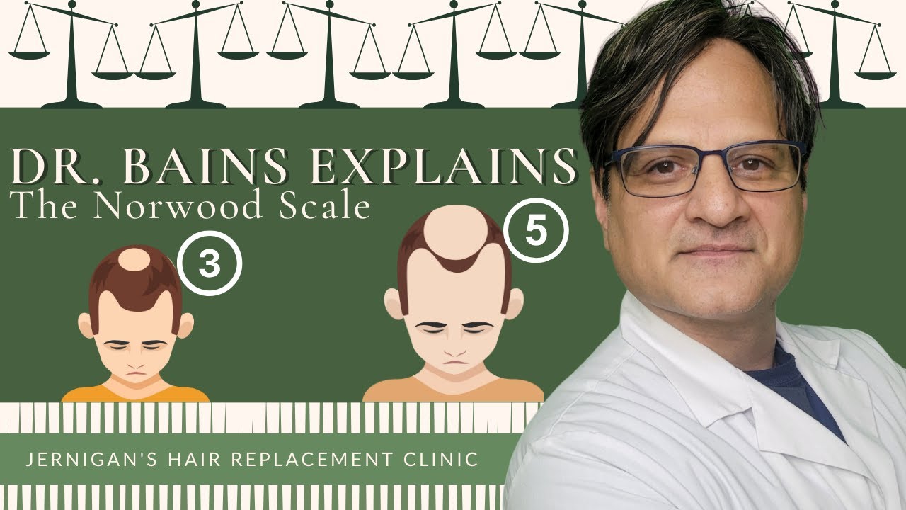 Dr. Bains Explains the Norwood Scale - YouTube