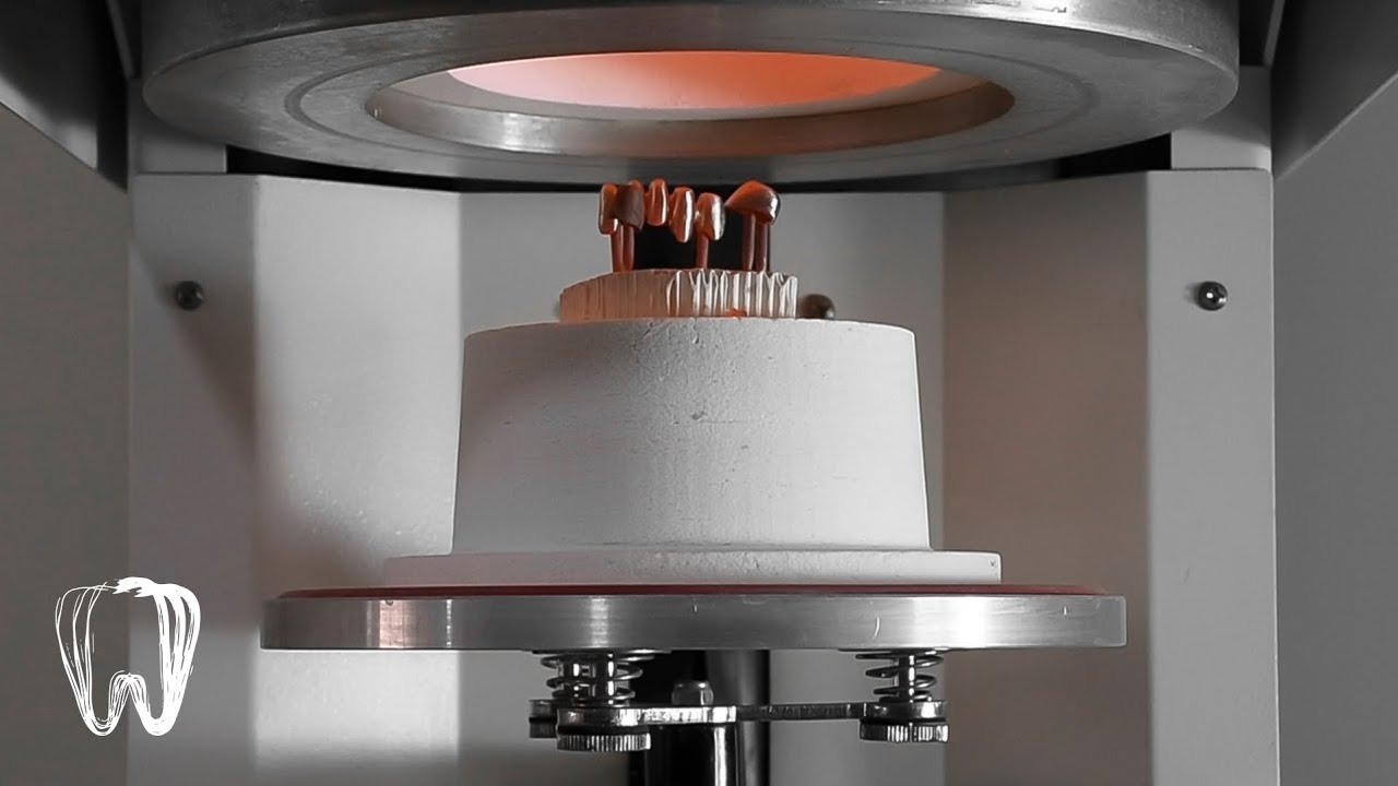 آموزش پودر گذاری دندانسازی PFM bridge start to finish porcelain bridge ...