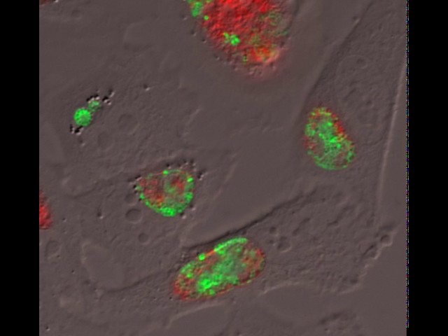 Chlamydia Trachomatis Microscopy