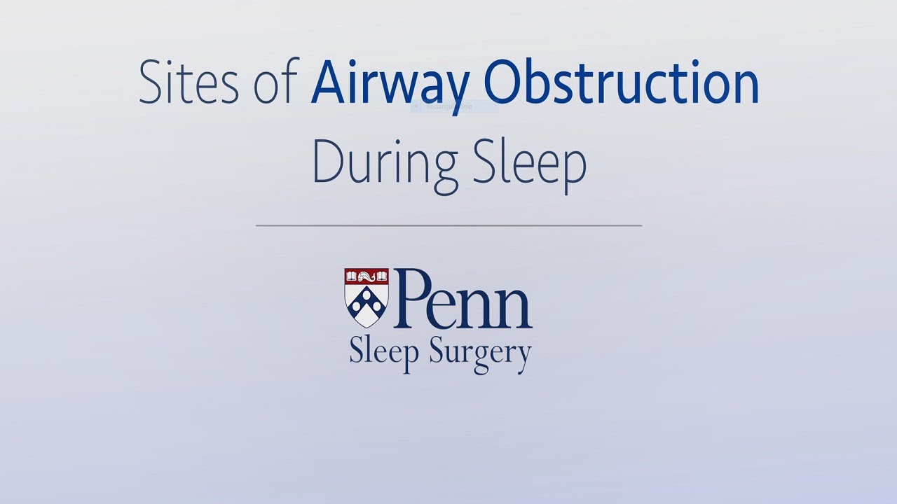 Introduction to Obstructive Sleep Apnea | Penn Sleep Surgery - YouTube