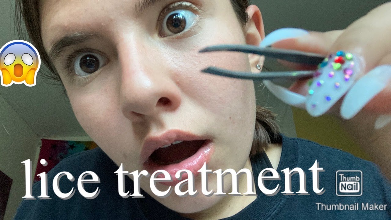 [ASMR] REMOVING YOUR LICE - ROLEPLAY - YouTube