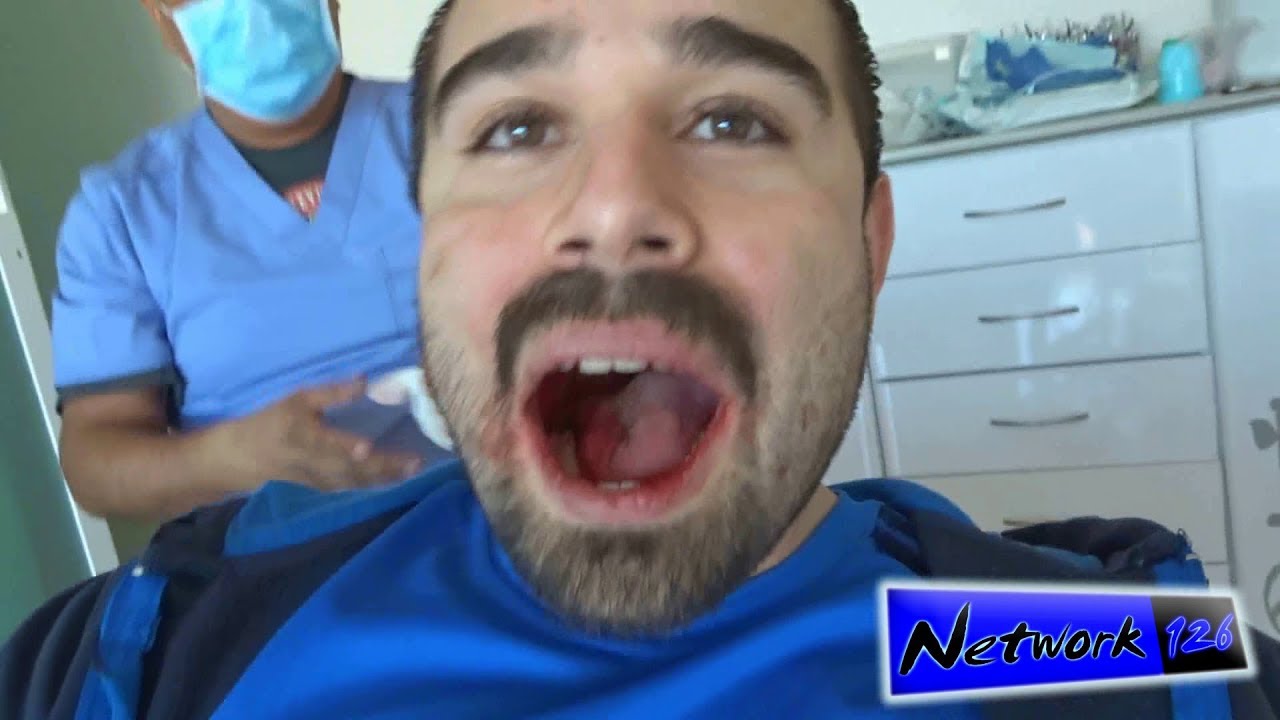 Wisdom tooth extraction in Mexico - (Entire experience walkthrough ...