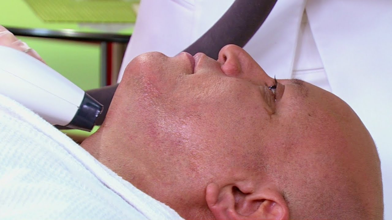 Aprende cómo puedes eliminar esa papada caída - YouTube